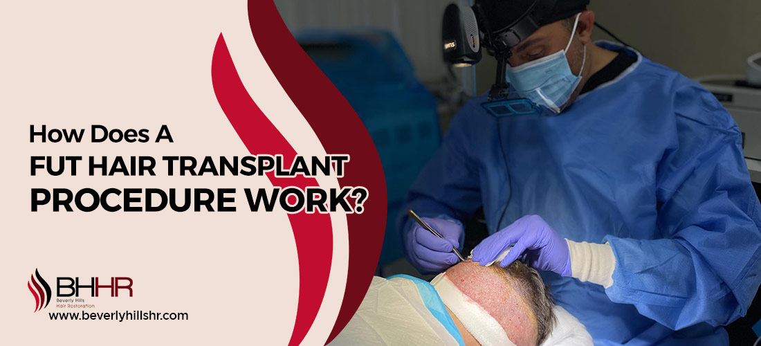 FUT Hair Transplant Procedure | Beverly Hills Hair Restoration